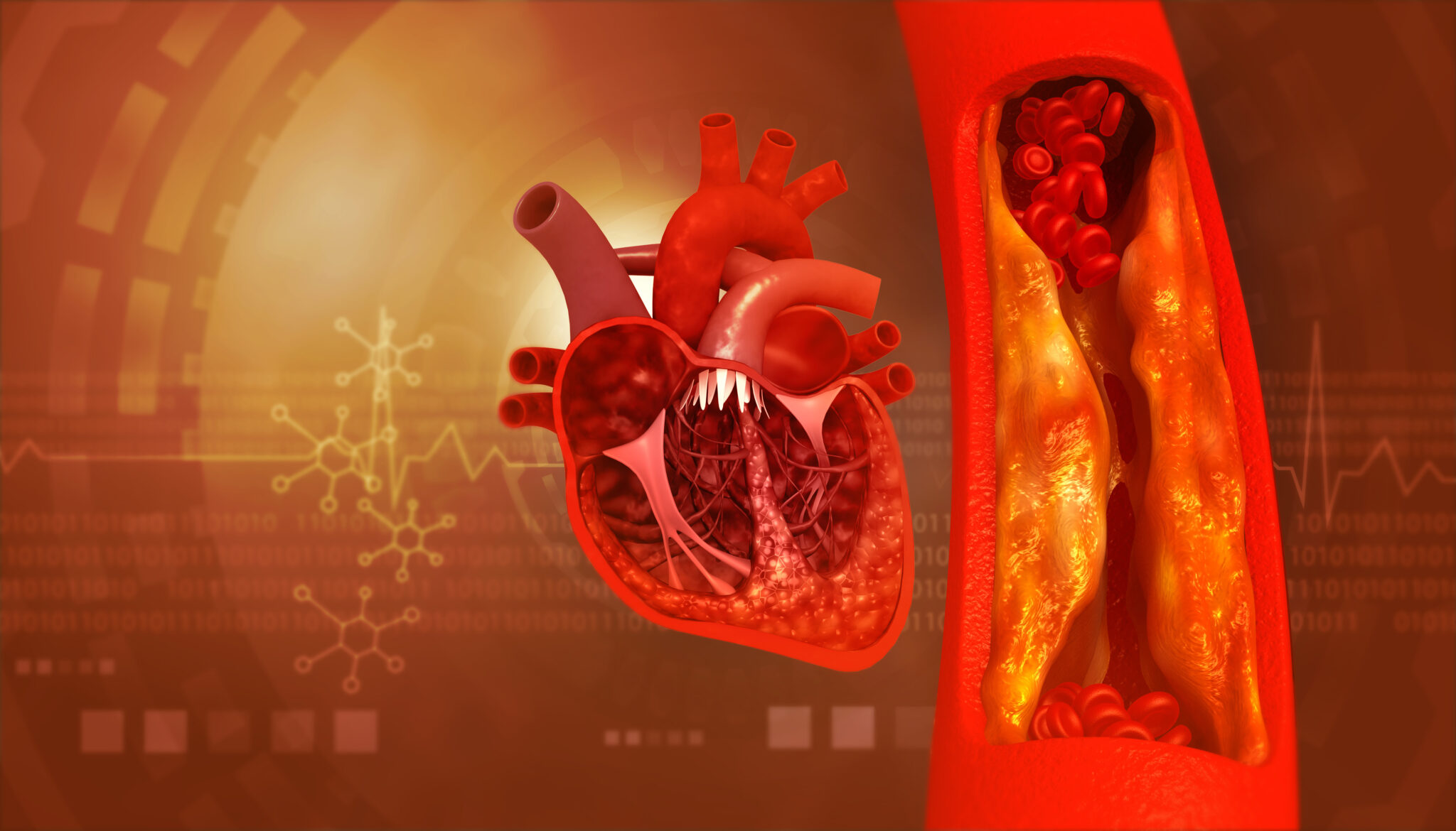 5 Vitamins to Include in Your Diet to Help Combat Arterial Plaque ...
