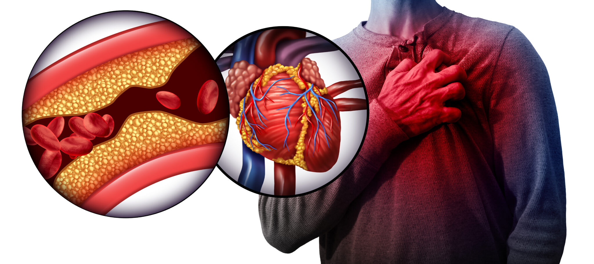 What is a Widowmaker Heart Attack? - Showit Blog